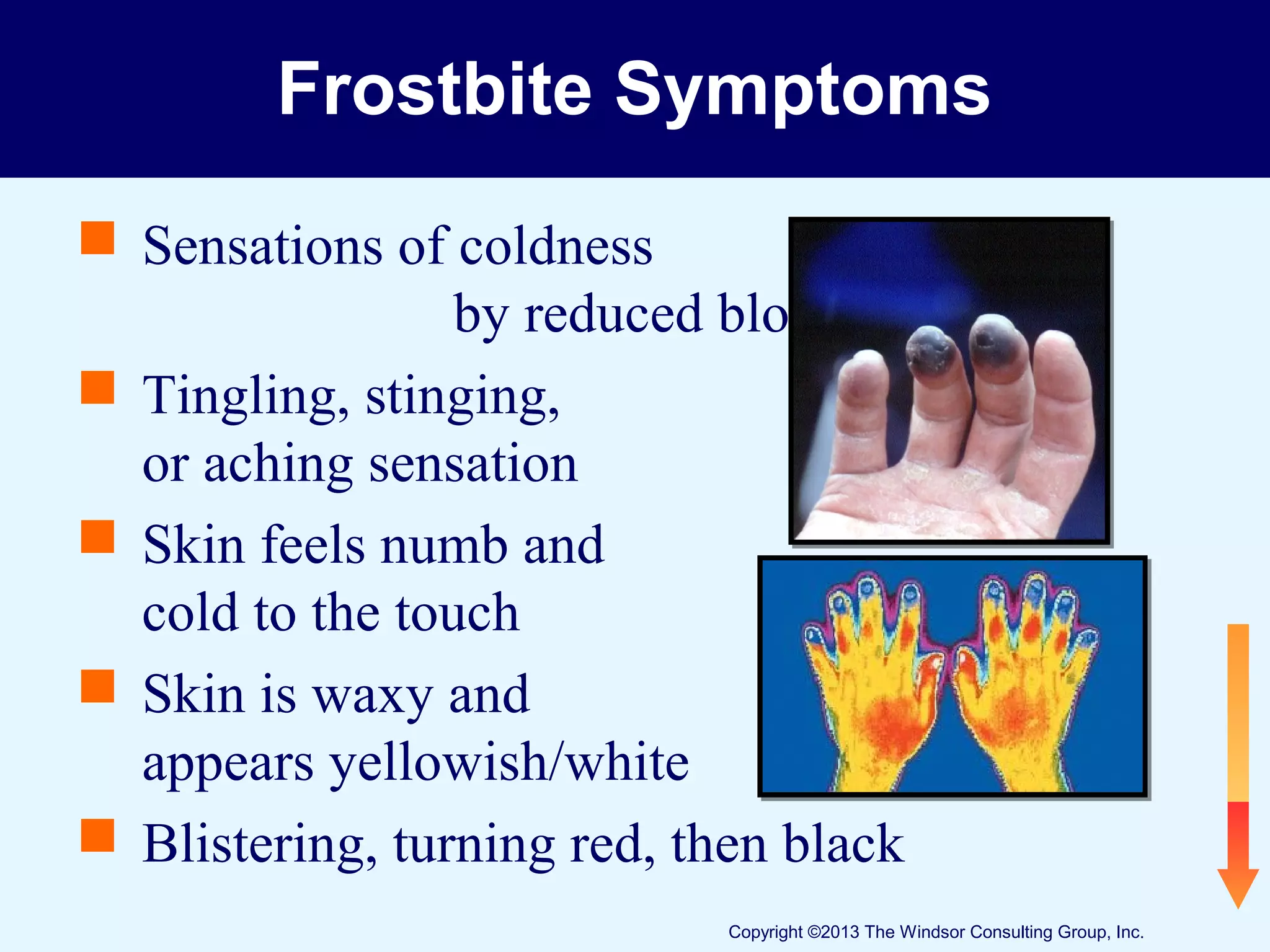 Cold Stress Hazards and Prevention | PPT