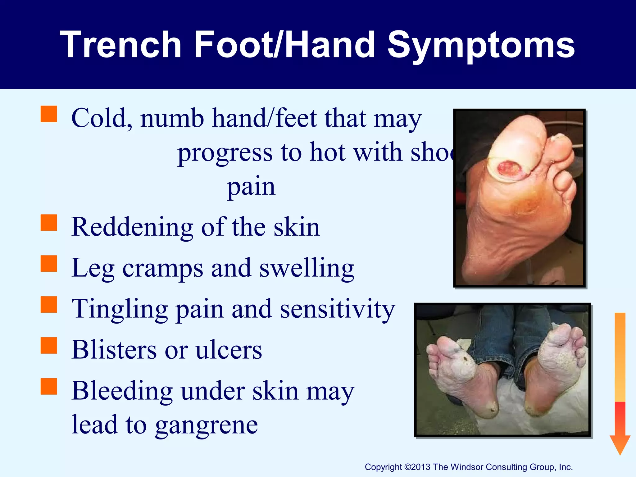 Cold Stress Hazards and Prevention | PPT