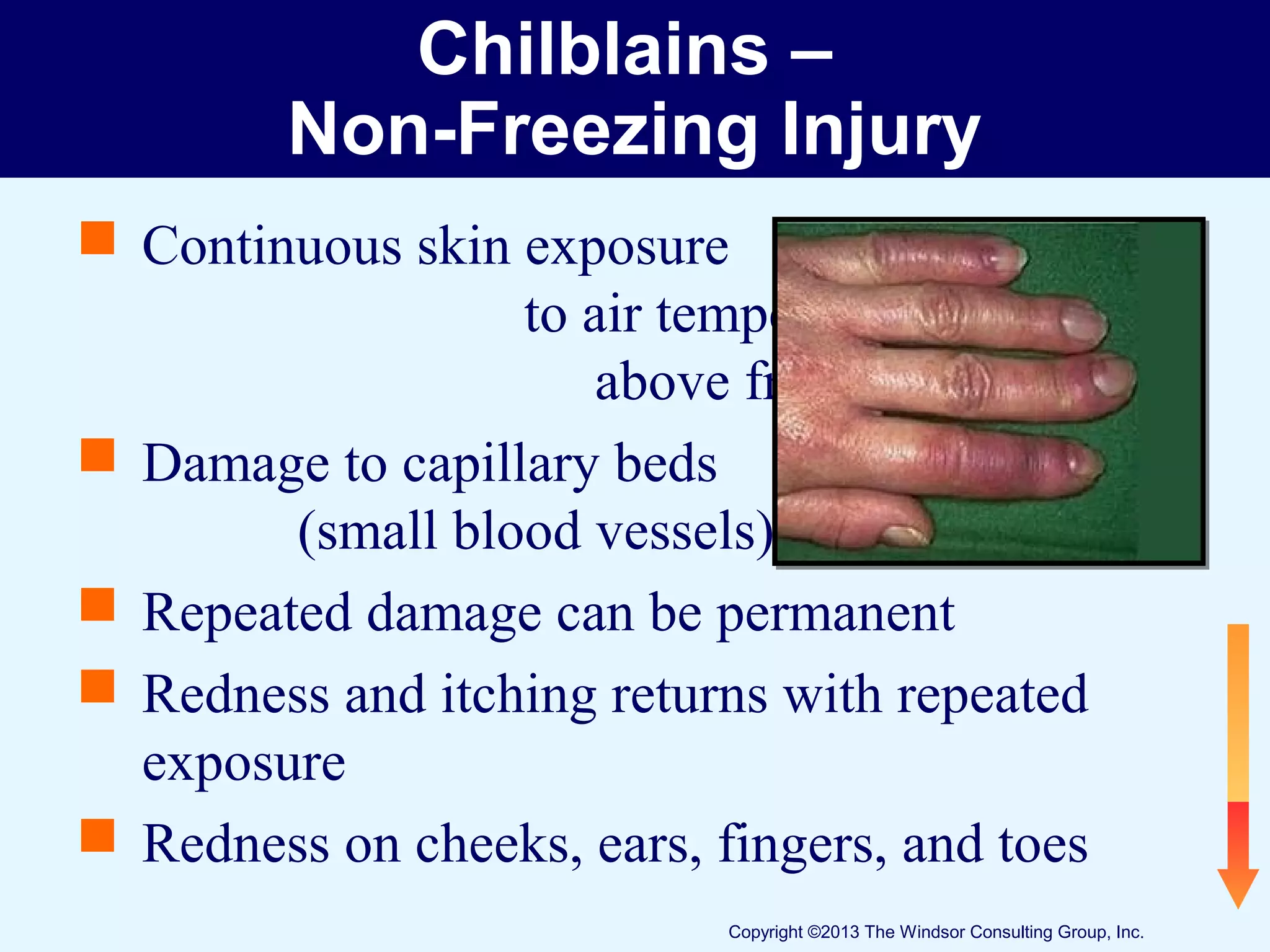 Cold Stress Hazards and Prevention | PPT