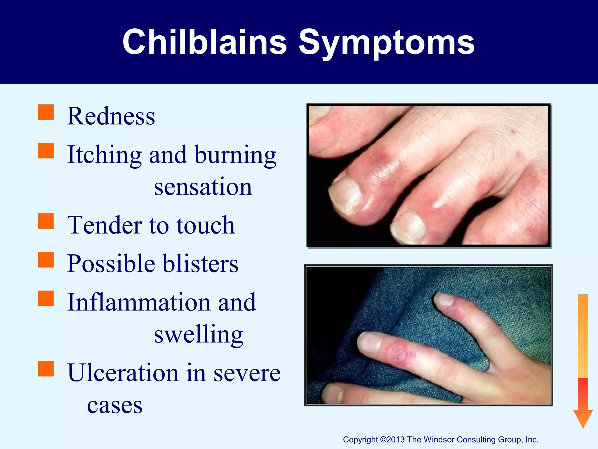 Cold Stress Hazards and Prevention | PPT