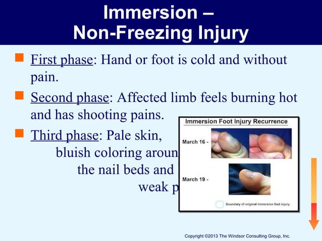 Cold Stress Hazards and Prevention | PPT | Endocrine and Metabolic ...