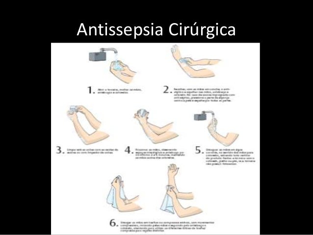 Assepsia e antissepsia