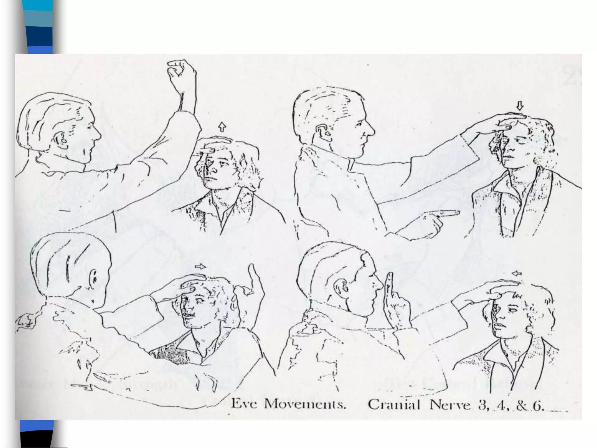 Assesment, interpretation n management of cranial nerve dysfunction | PPTX