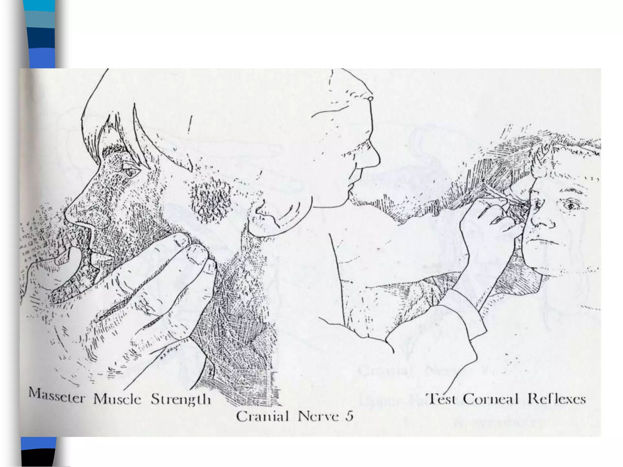 Assesment, interpretation n management of cranial nerve dysfunction | PPTX