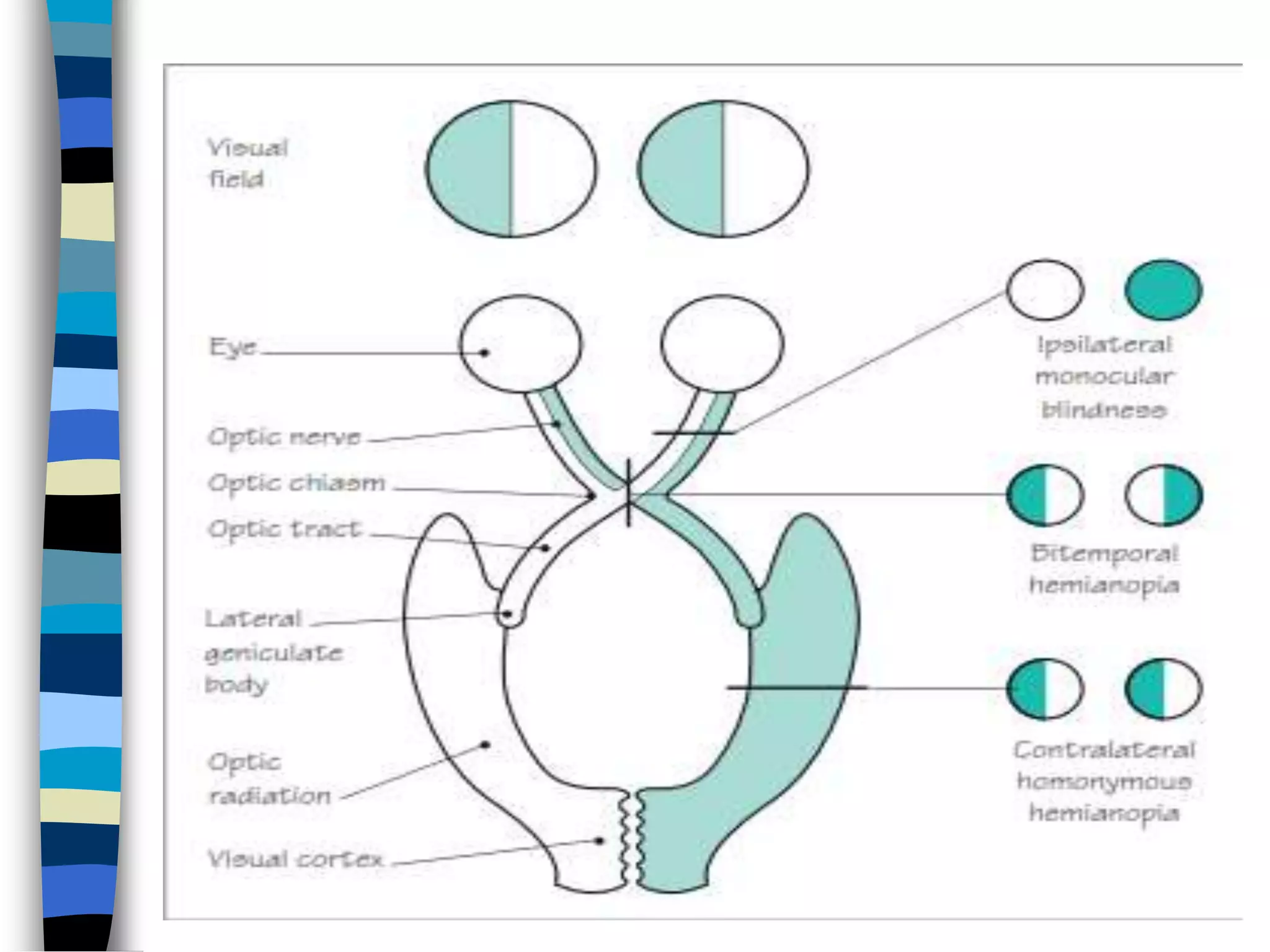 Assesment, interpretation n management of cranial nerve dysfunction | PPTX