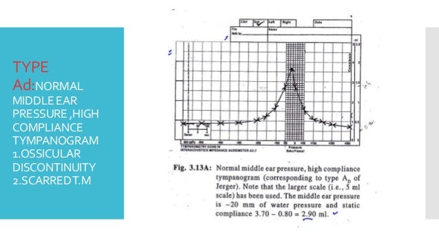 Assesment of hearing