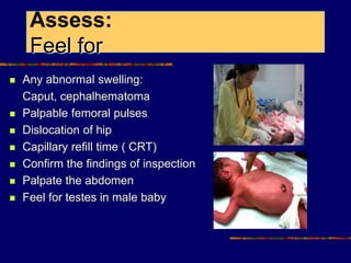 Assesment of the newborn baby kuliah | PPTX