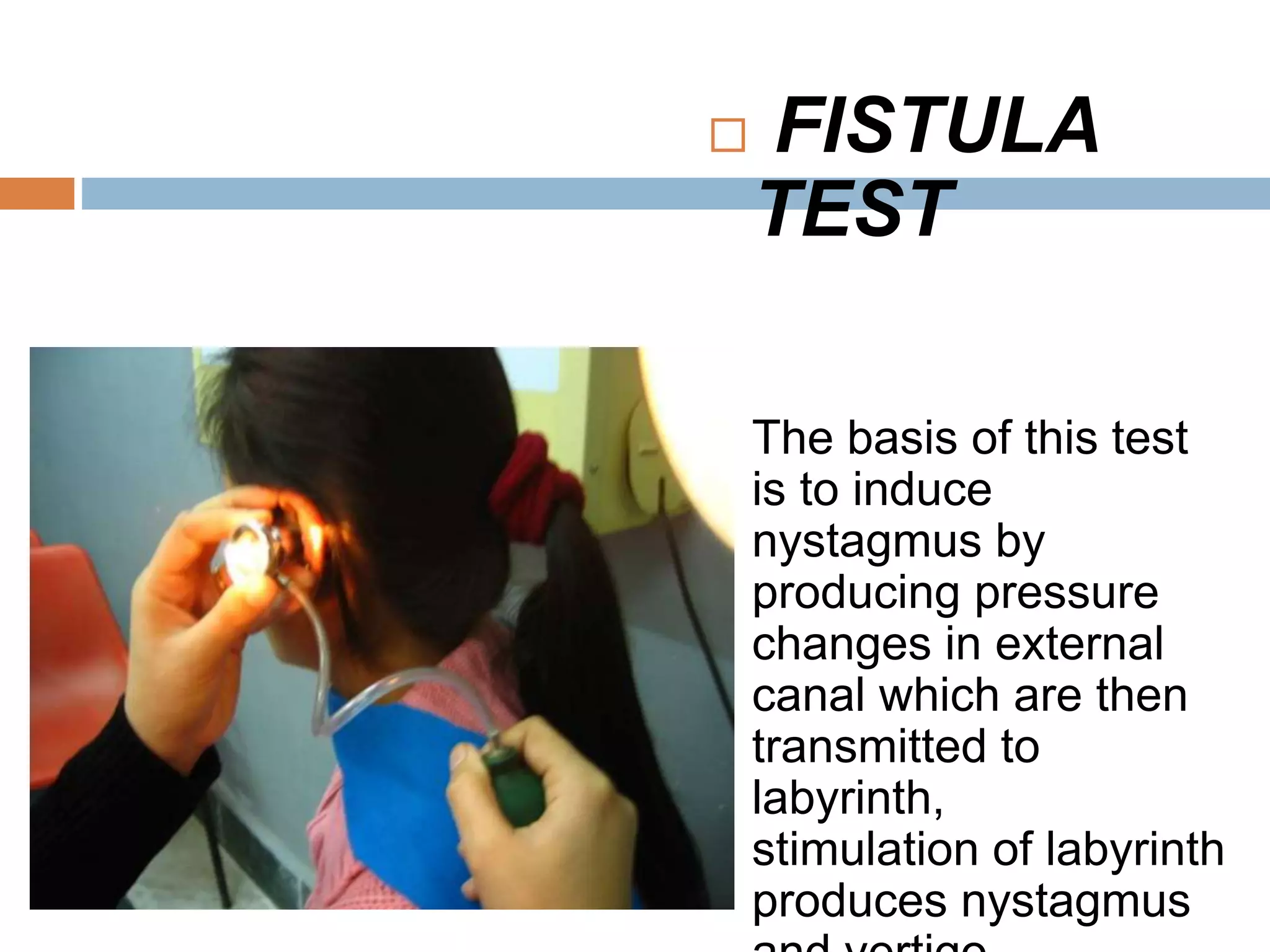 Assesment of vestibular function | PPTX