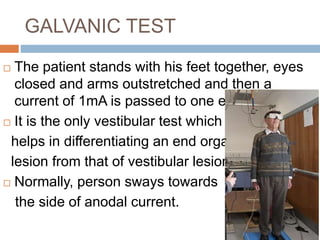 Assesment of vestibular function | PPTX