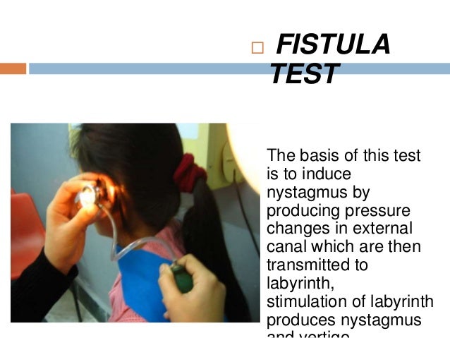 Assesment of vestibular function