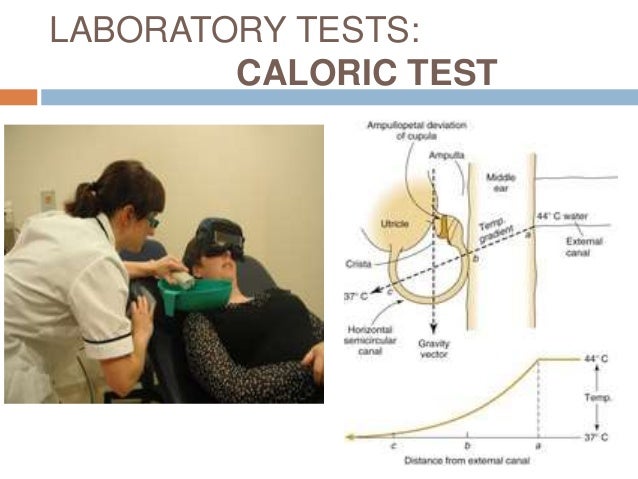Assesment of vestibular function