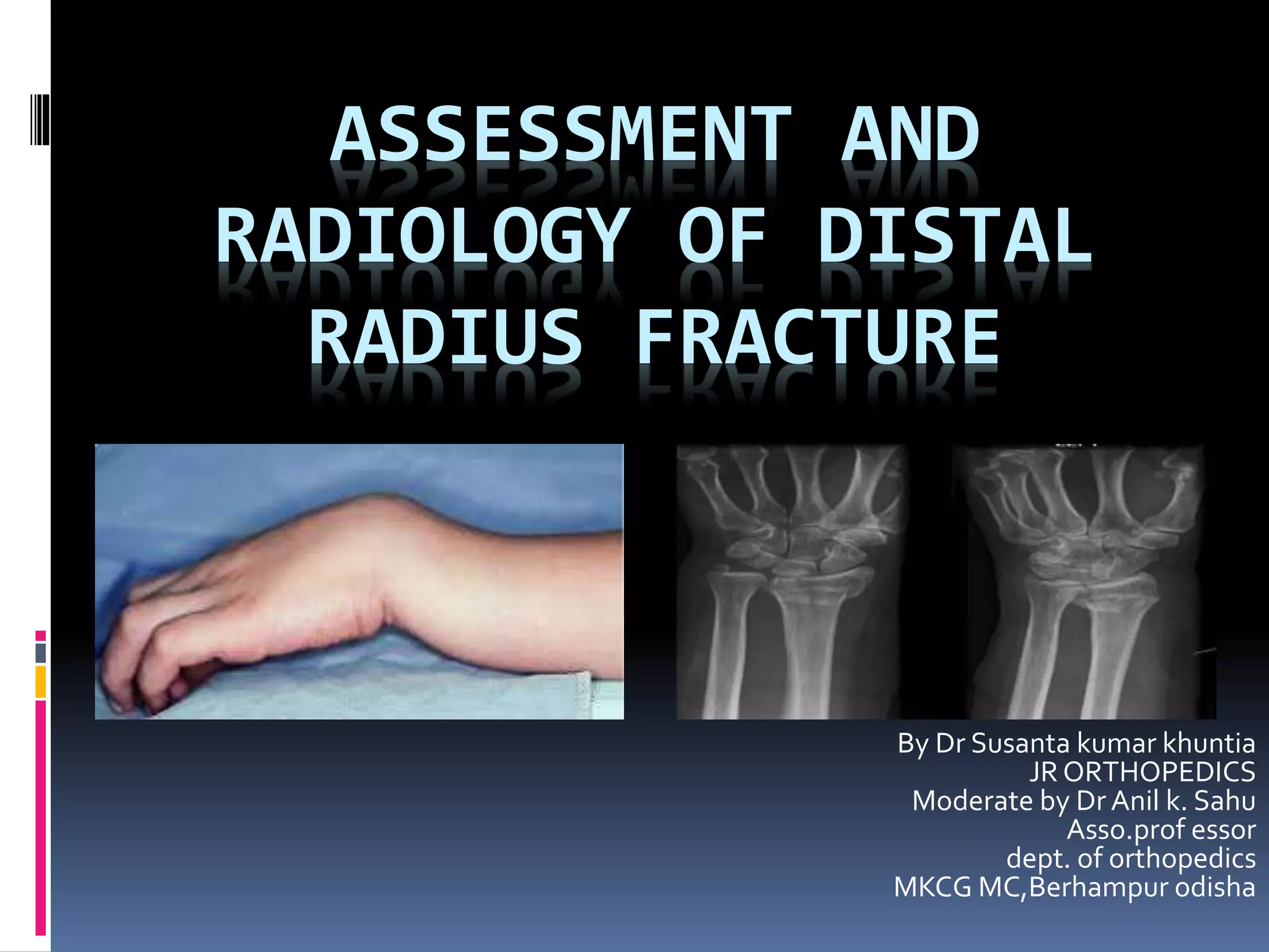 Assessent and radiology of distal end radius fracture | PPTX