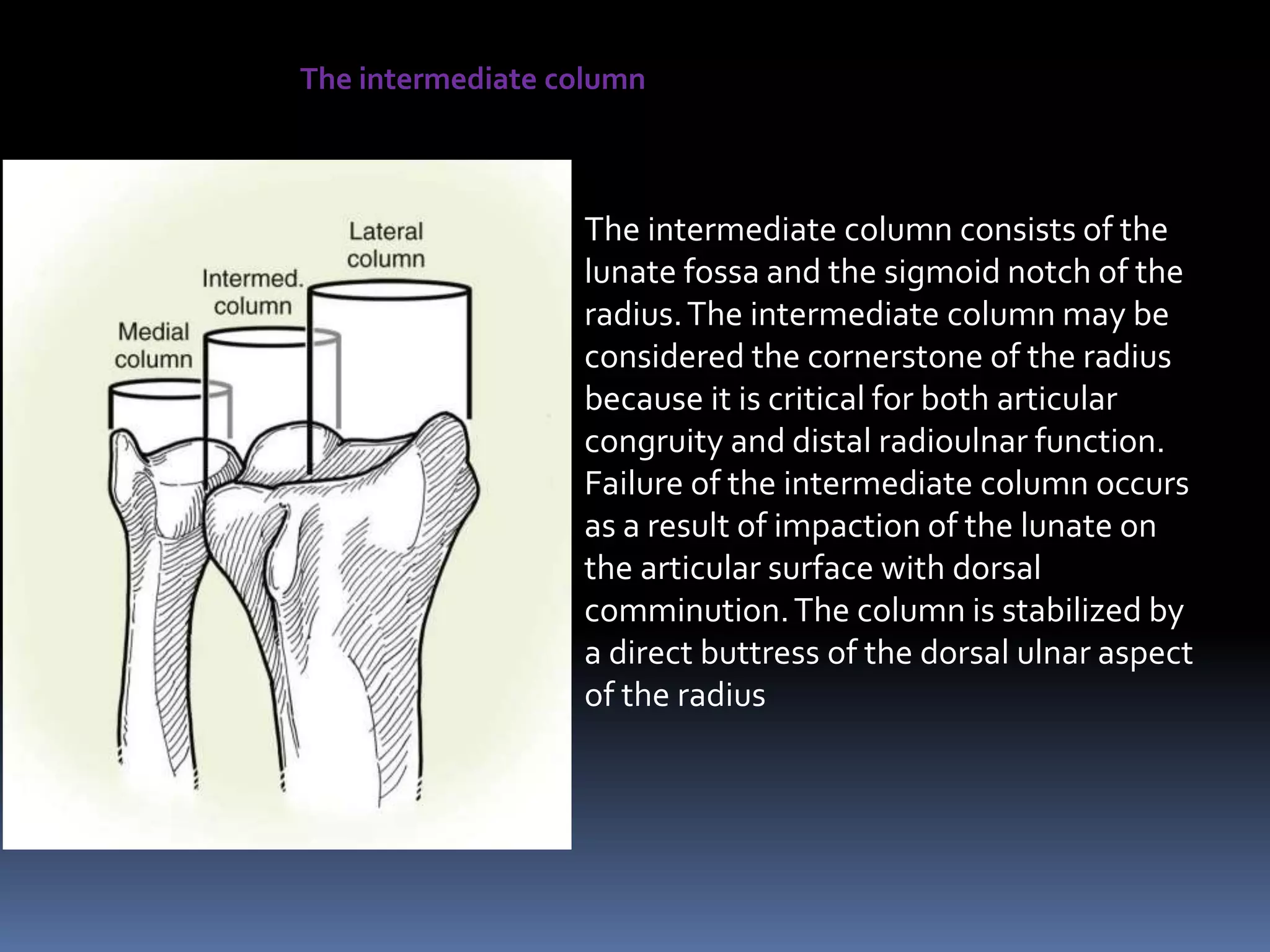 Assessent and radiology of distal end radius fracture | PPTX