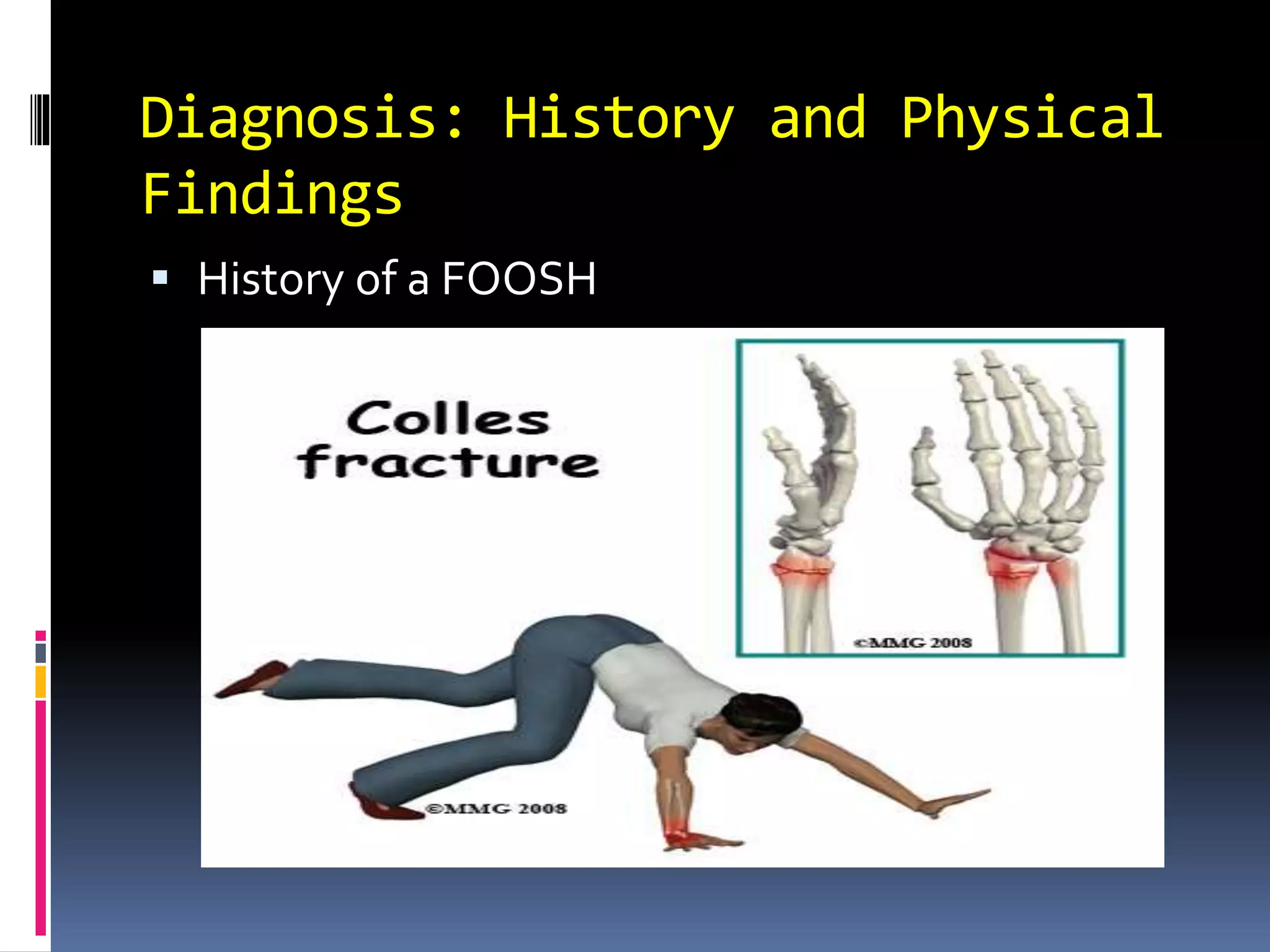 Assessent and radiology of distal end radius fracture | PPTX