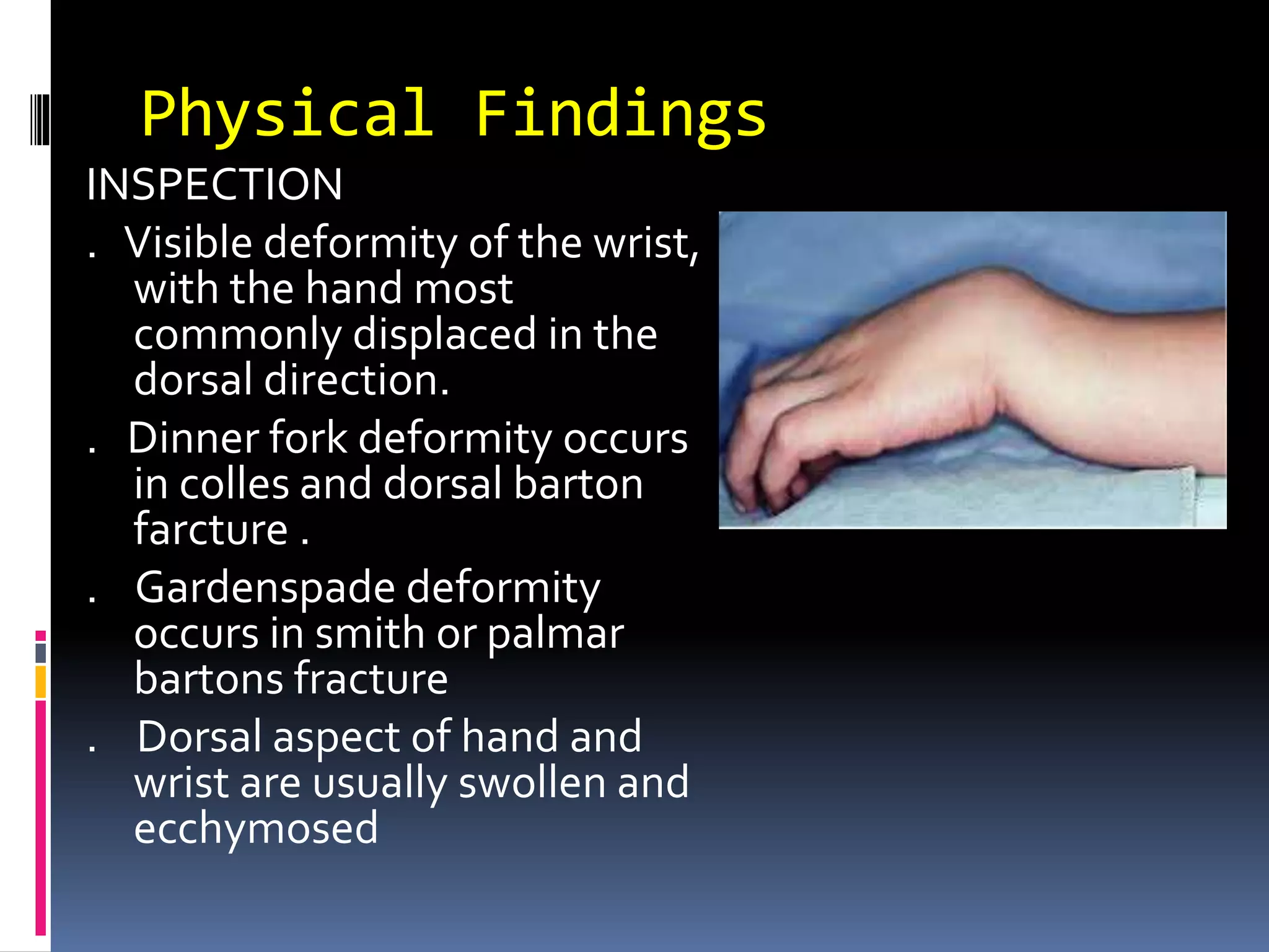 Assessent and radiology of distal end radius fracture | PPTX