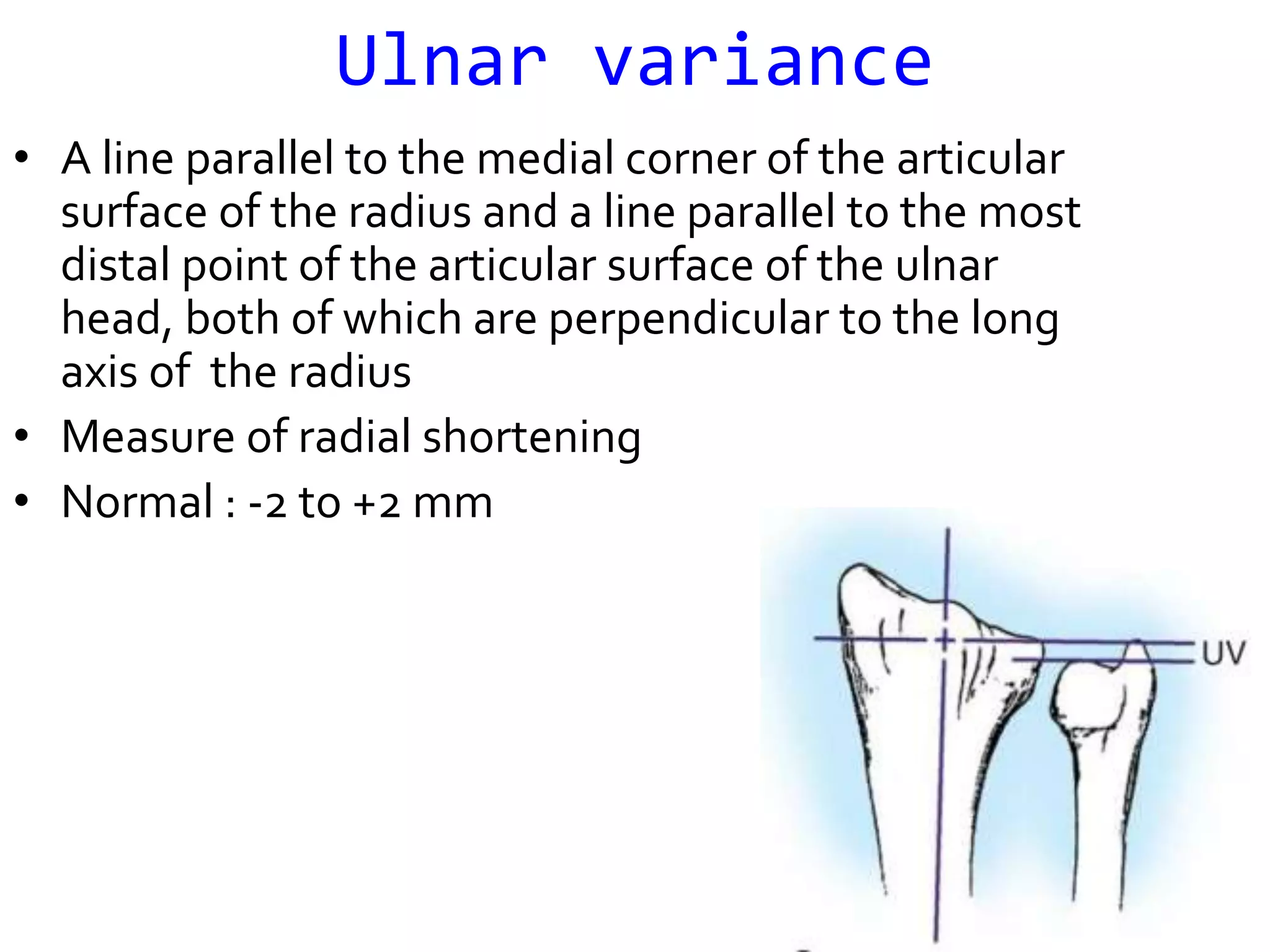 Assessent and radiology of distal end radius fracture | PPTX