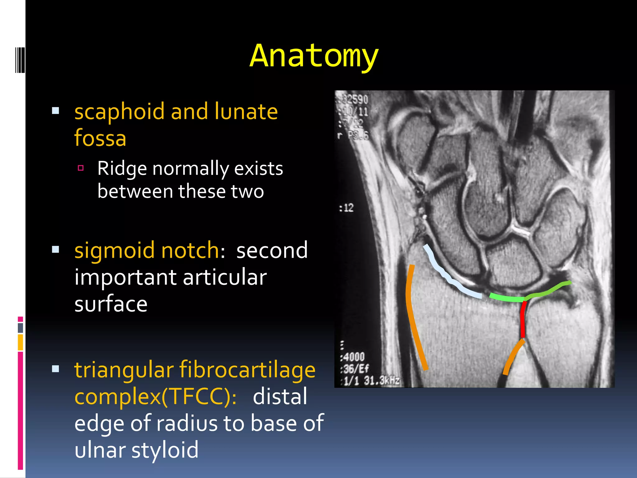 Assessent and radiology of distal end radius fracture | PPTX
