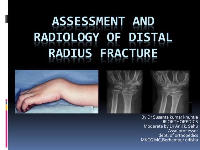 Assessent and radiology of distal end radius fracture | PPTX