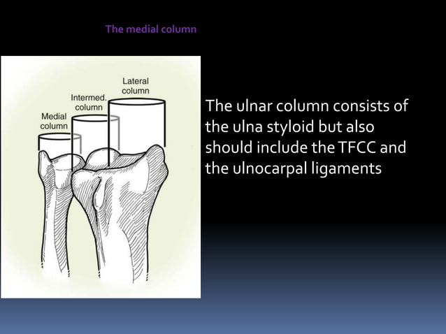 Assessent and radiology of distal end radius fracture | PPTX