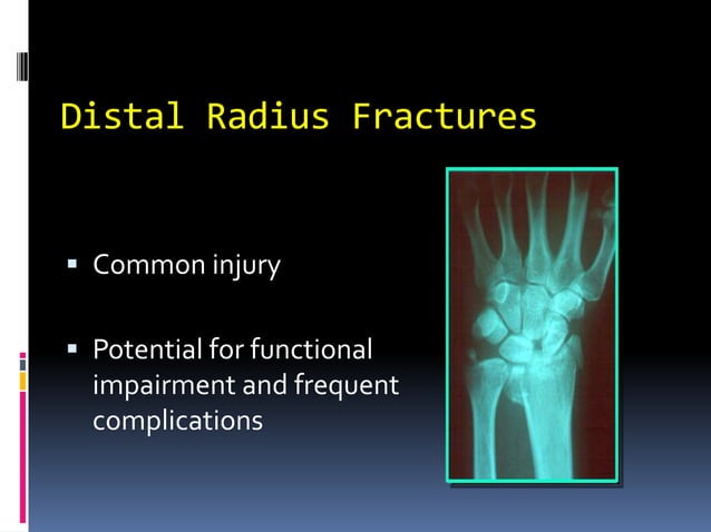 Assessent and radiology of distal end radius fracture | PPTX