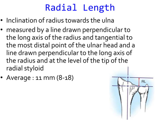 Assessent and radiology of distal end radius fracture | PPTX