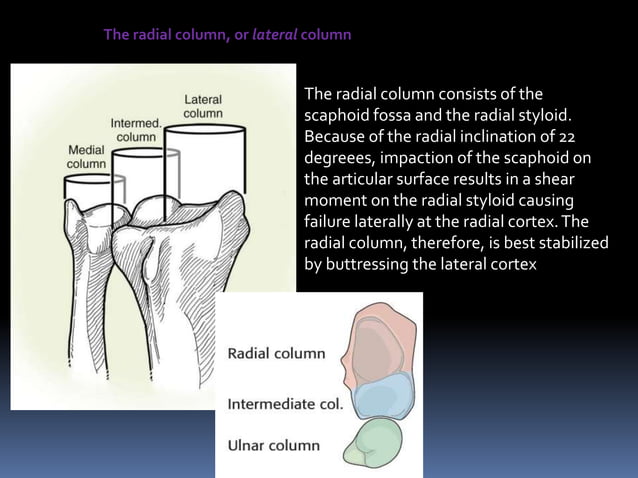 Assessent and radiology of distal end radius fracture | PPTX