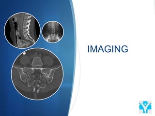 Assessing back pain in rheumatology | PPTX
