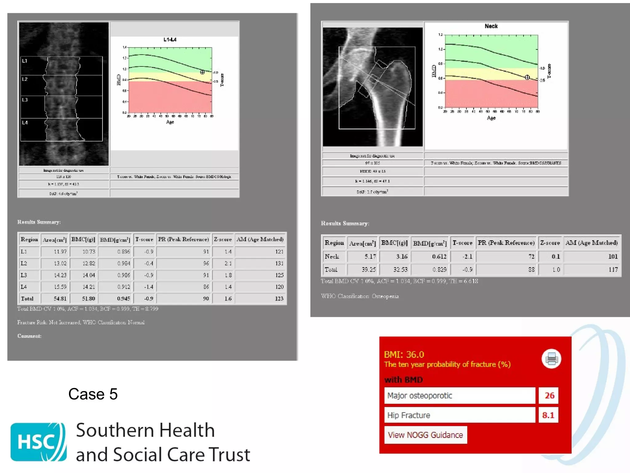 Assessing Fracture Risk | PPT