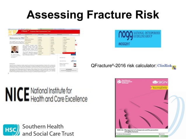 Assessing Fracture Risk | PPT | Bone and Joint Conditions | Diseases ...