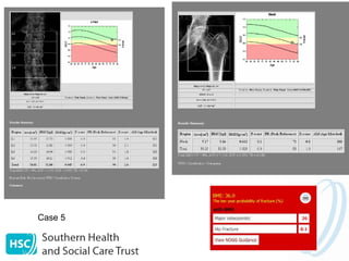 Assessing Fracture Risk | PPT