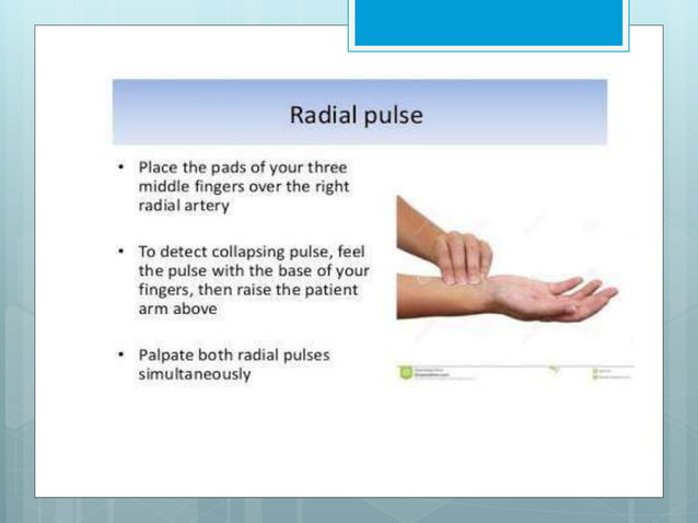 Assessing Radial Pulse | PPT