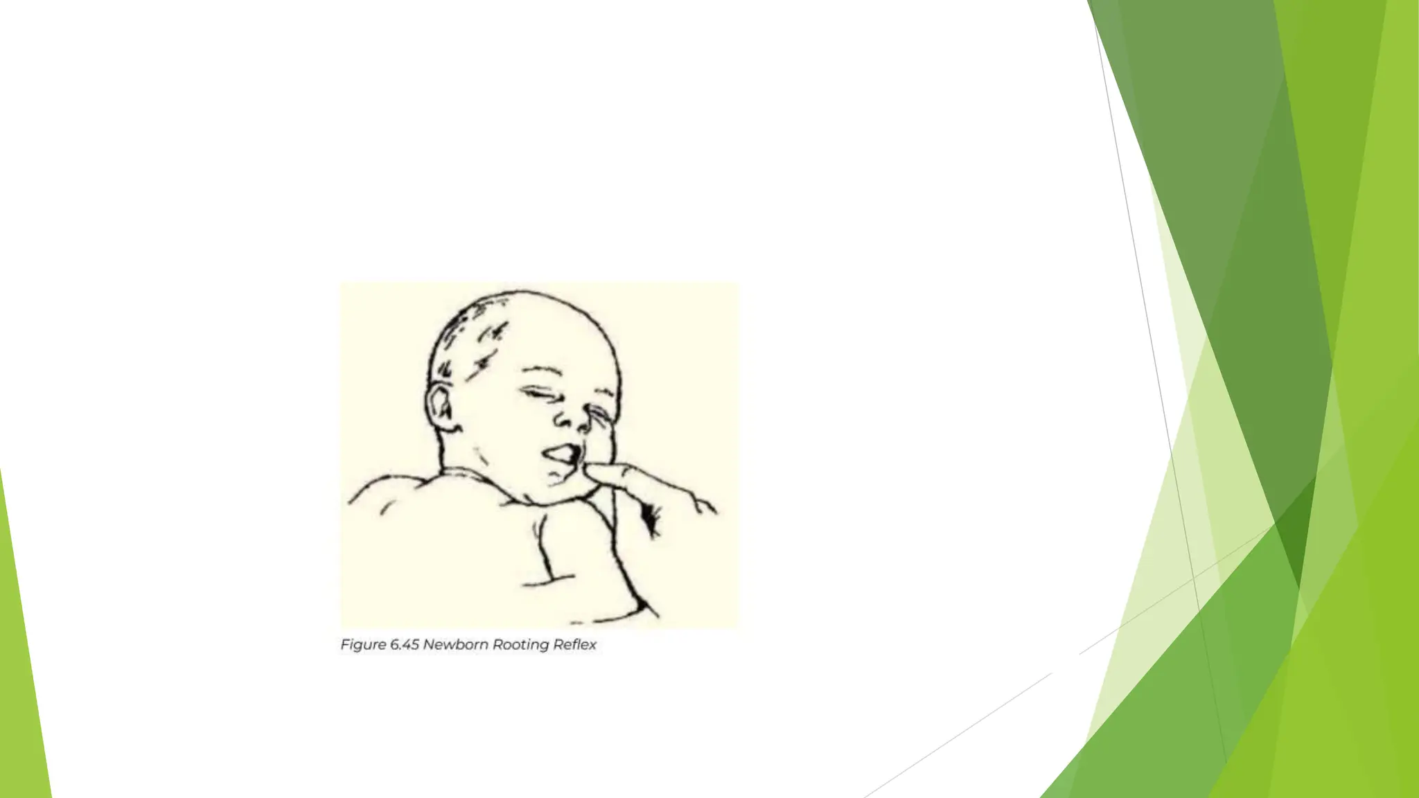 Assessing Reflexes of children in paediatrics pptx | PPTX