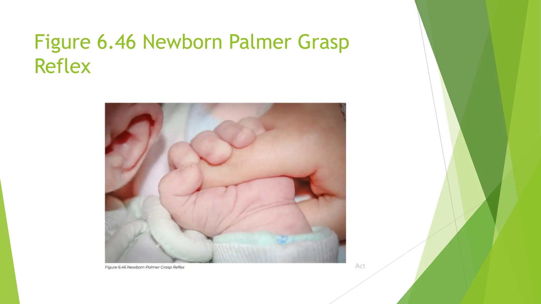 Assessing Reflexes of children in paediatrics pptx | PPTX