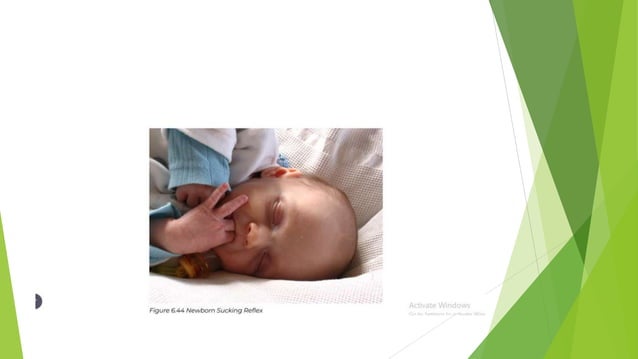 Assessing Reflexes of children in paediatrics pptx | PPTX | Pregnancy ...
