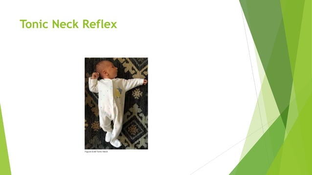 Assessing Reflexes of children in paediatrics pptx | PPTX | Pregnancy ...