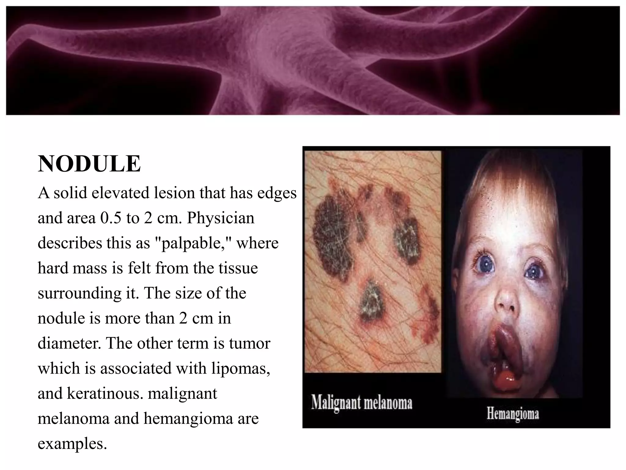 Assessing the skin | PPTX