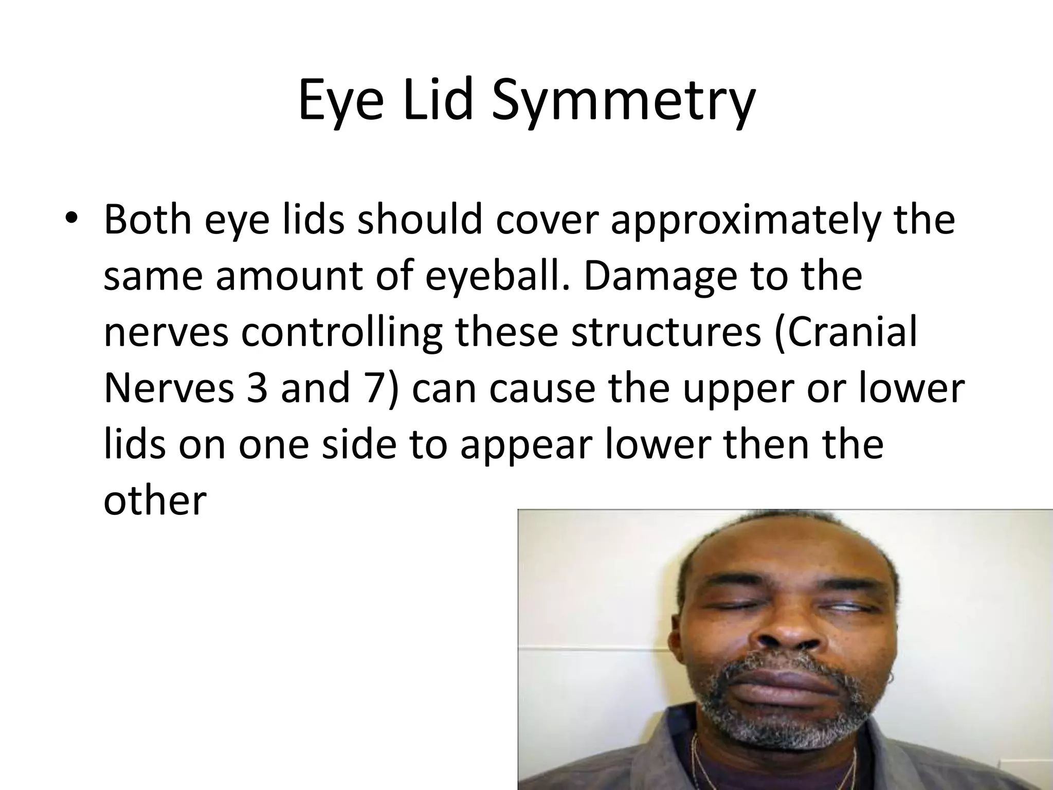 EYE Assessment | PPTX