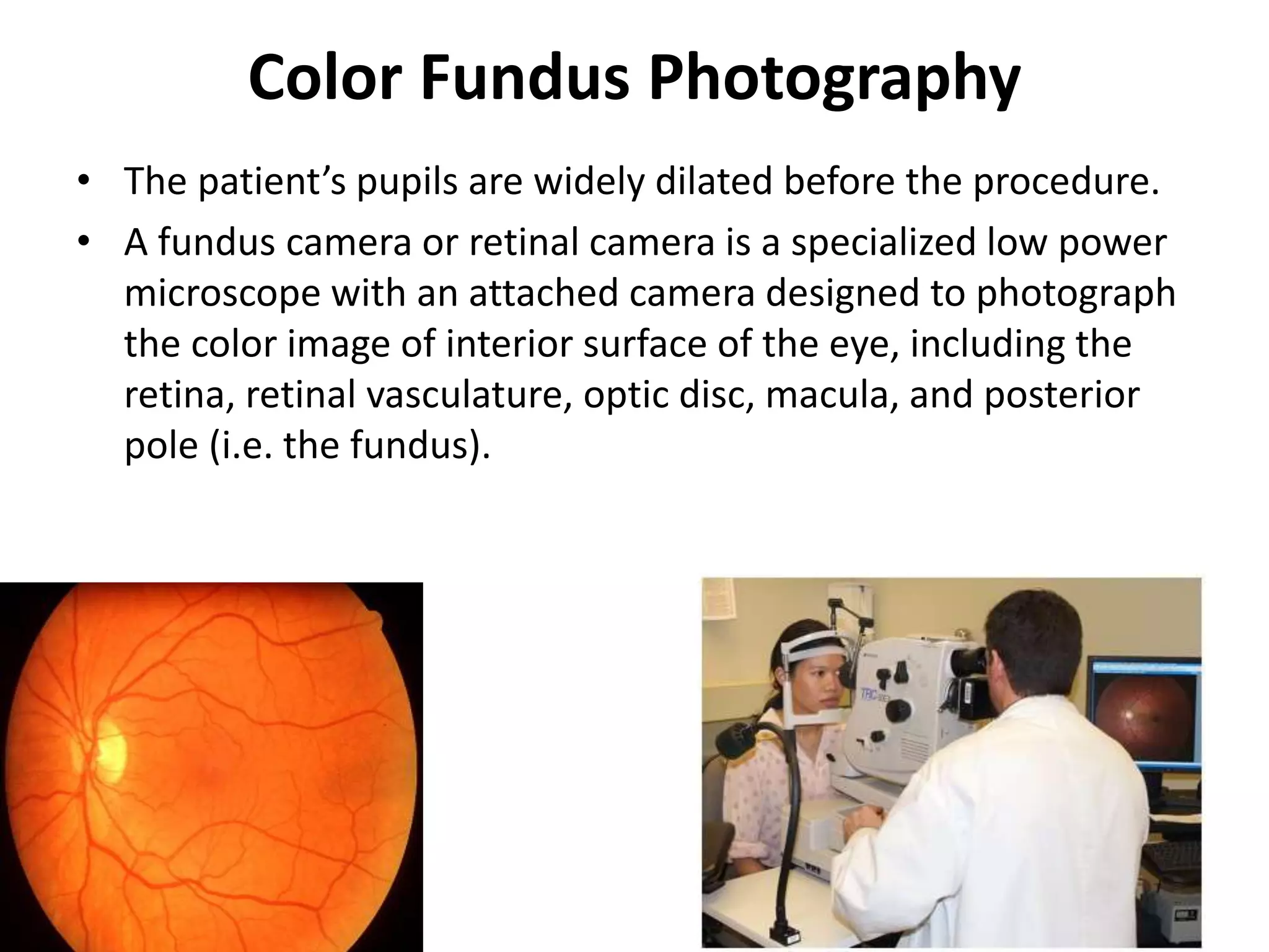 EYE Assessment | PPTX