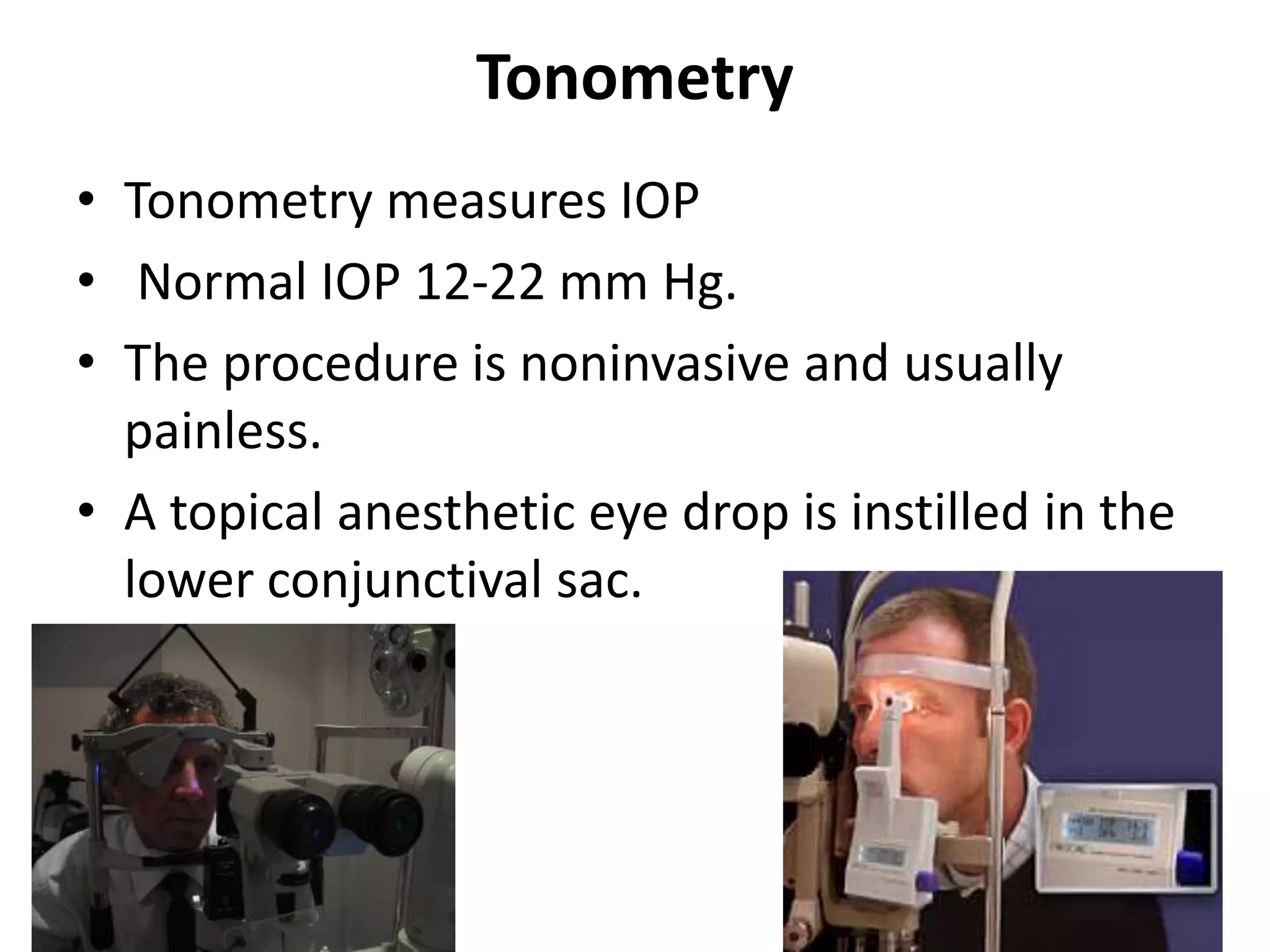 EYE Assessment | PPTX
