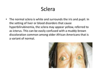 EYE Assessment | PPTX