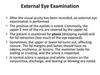 EYE Assessment | PPTX