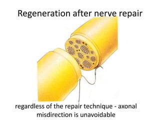 Assessment of peripheral nerve surgery | PPTX