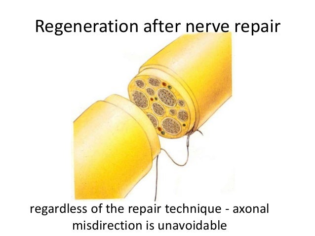 Assessment of peripheral nerve surgery