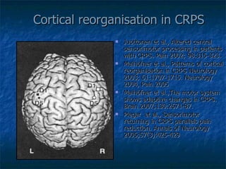 Assessment Of Complex Regional Pain Syndrome Dr Candy Mccabe | PPT