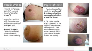 Assessment-of-the-Breast.for nursing studentspptx | PPTX