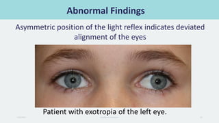 Health assessment - eyes Nursing Lecture | PPT