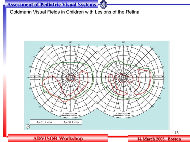 Assessment of the Pediatric Visual System | PPT | Eye and Vision ...