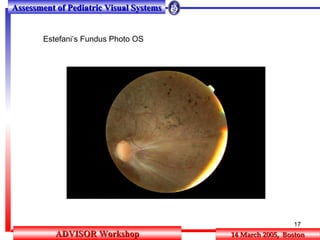 Assessment of the Pediatric Visual System | PPT