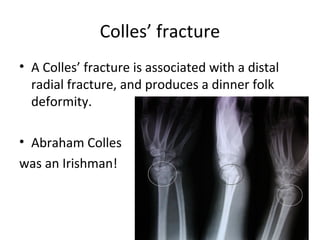 Assessment Questions | PPT