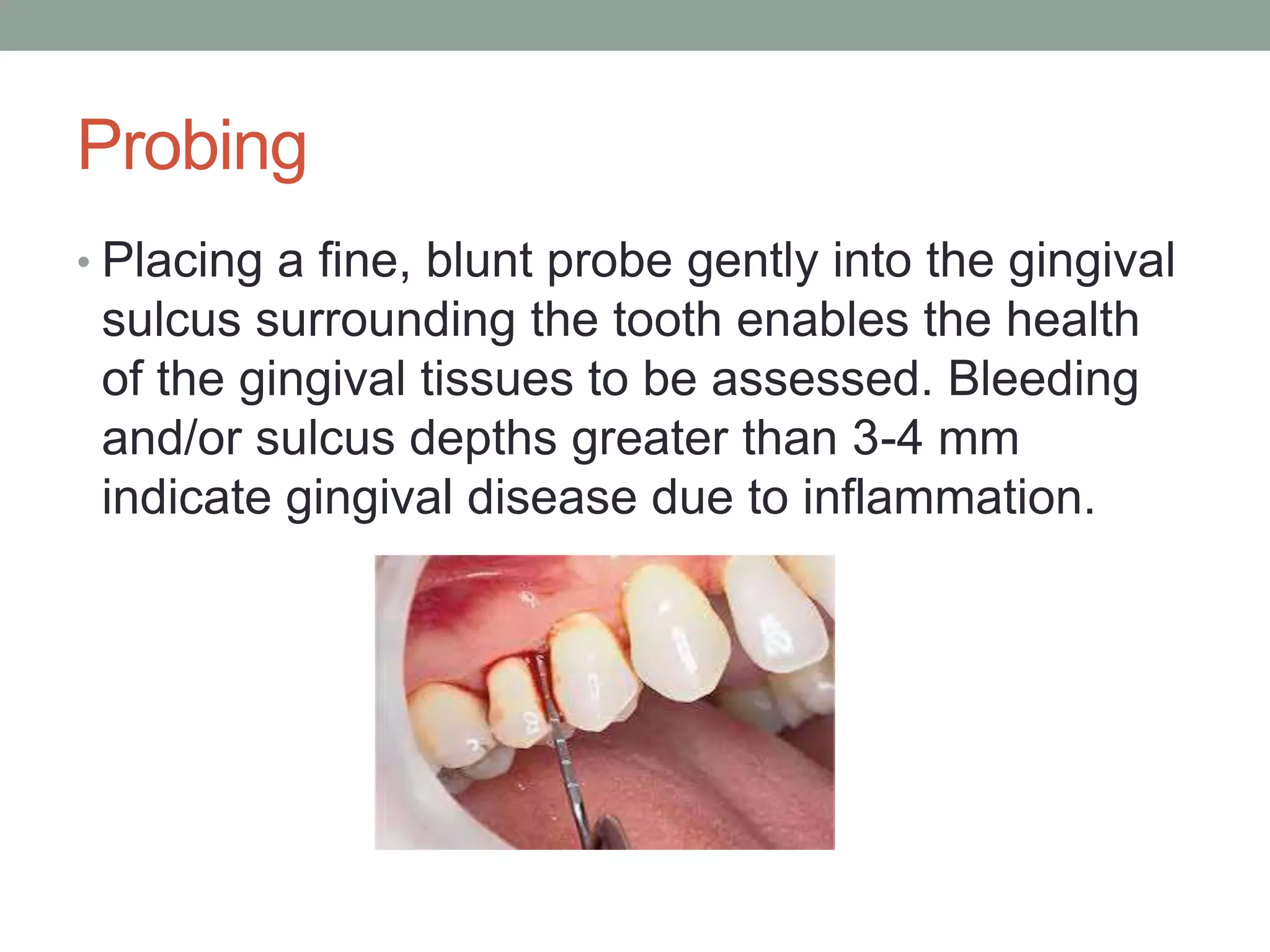 Assessment and diagnosis of pain in dental practice | PPTX